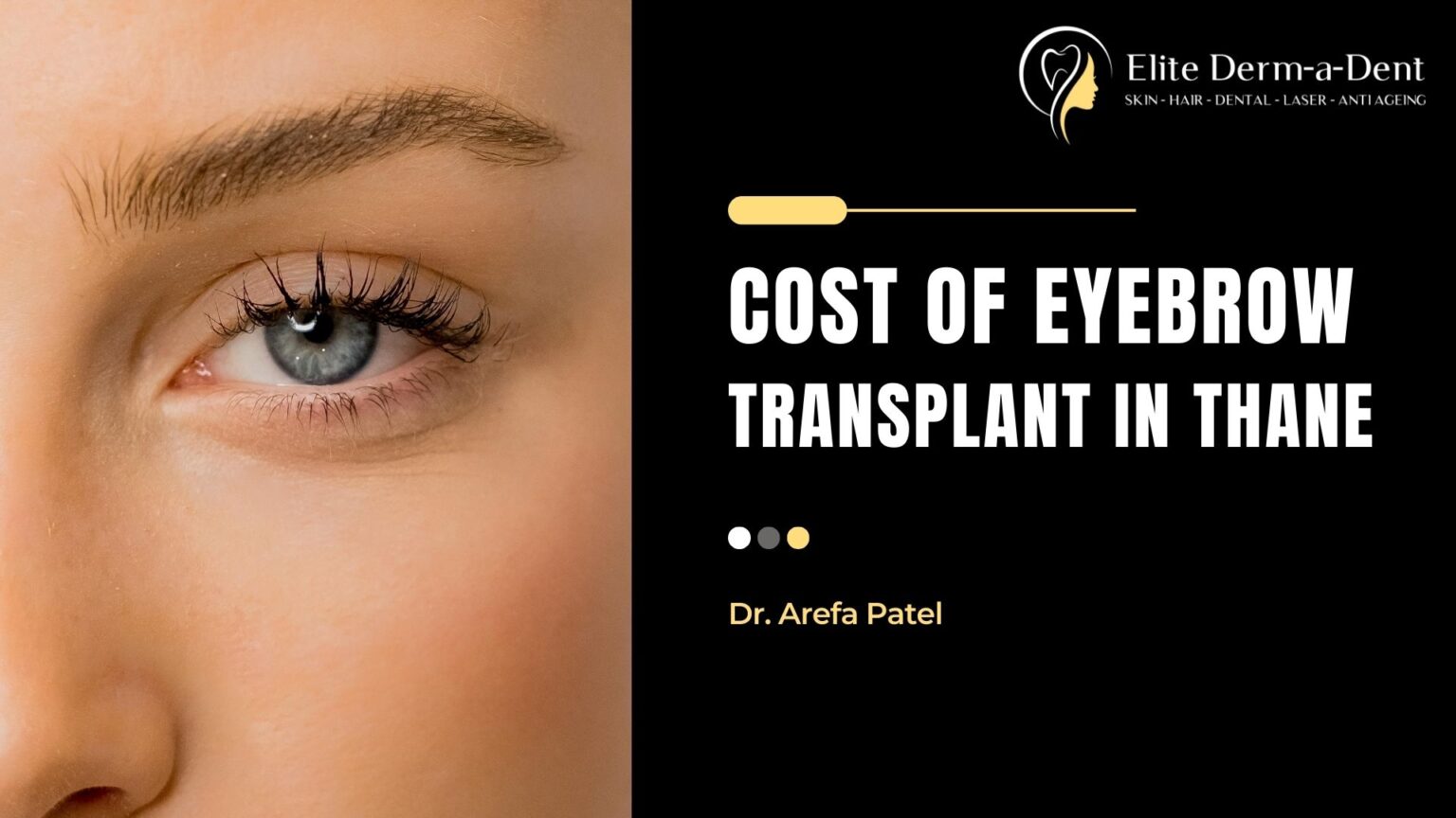 Understanding Cost Of Eyebrow Hair Transplant In Thane 2025: A Complete ...